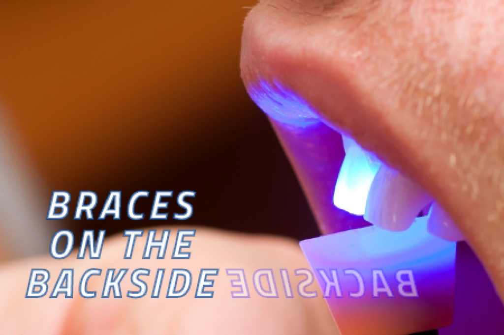 Get Your Braces On The Backside in Atlanta, GA | Chamblee Orthodontics