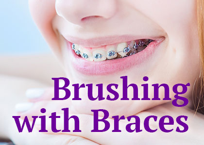 Brushing with Braces in Atlanta, GA | Chamblee Orthodontics