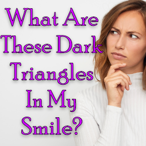 Dark Triangles Between Teeth | Chamblee Orthodontics Atlanta, GA