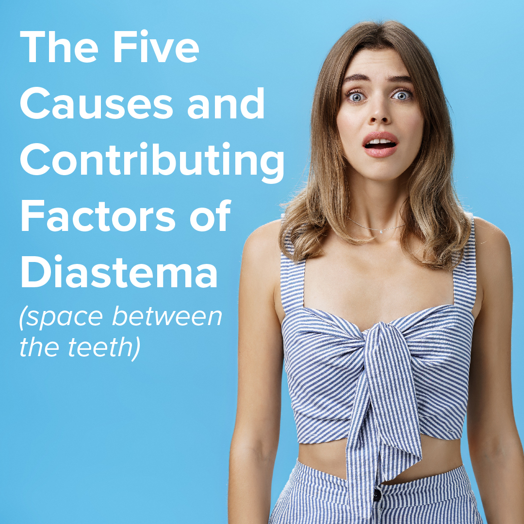 Diastema | Chamblee Orthodontics | Atlanta, GA