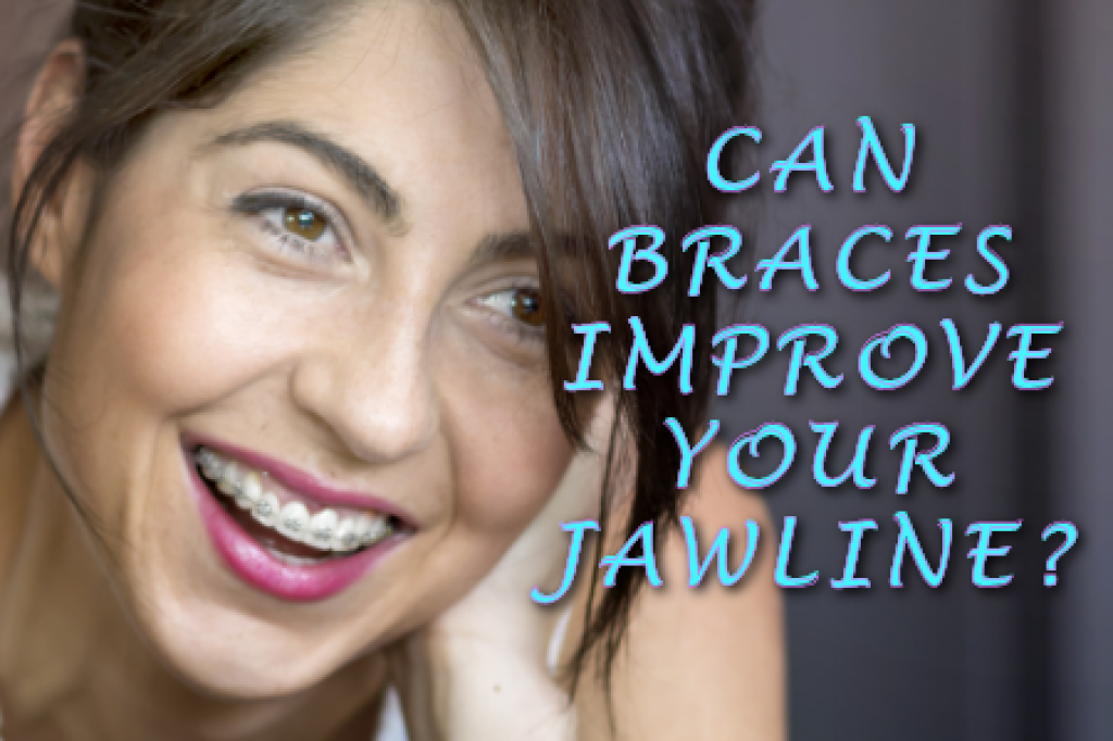 Can Ortho improve jawlines? Chamblee Orthodontics | Atlanta, GA