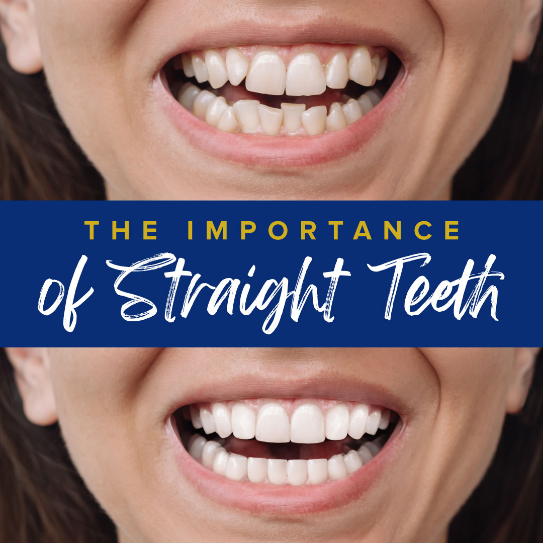 The Importance of Straight Teeth for Your Health | Chamblee ...